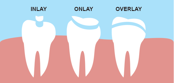 Smile Now Family Dental